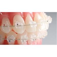 Koden Basic MBT Ceramic Bracket Kit